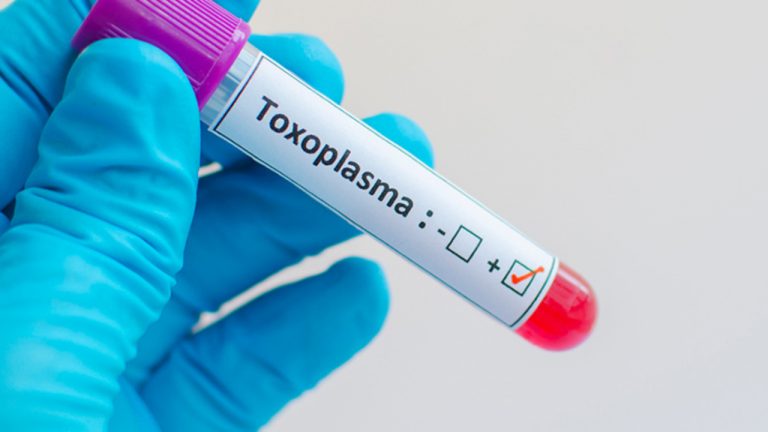 Toxoplasmosis: síntomas, causas y formas de afectar - Como Funciona Que